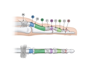 Anatomie - Spaltung des A1-Ringbandes