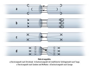 Kirchmayr Kessler Nahttechnik _ Anatomie – FYVISM