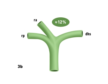 Anatomie - Cholezystektomie, offen