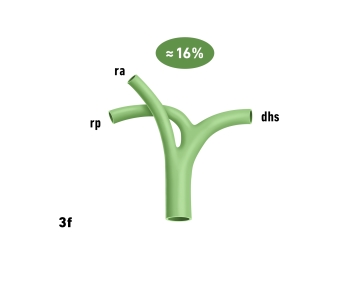 Anatomie - Cholezystektomie, offen