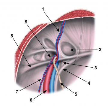 Anatomie - Leistenhernienreparation, transabdominelle präperitoneale ...