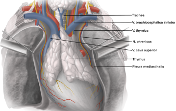 Anatomie - VATS Thymektomie