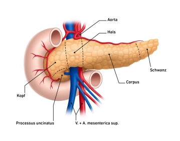 Anatomie - Pankreaslinksresektion, milzerhaltend, robotisch assistiert